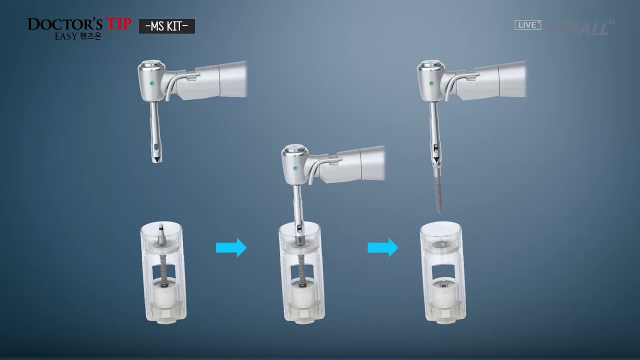 [Easy Hands-on] ep10 MS KIT - #41 Missing Case