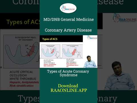 Types of Acute Coronary Syndrome