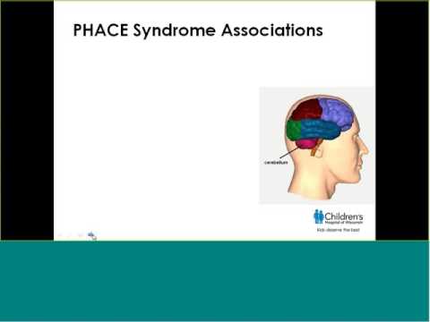 PHACE Syndrome: Long-term outcomes