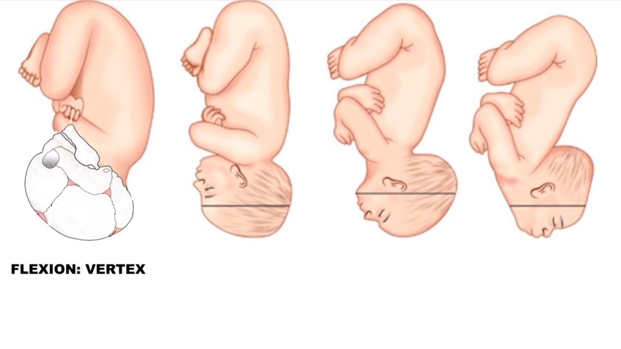Fetal Skull Diameters Made Easy - Obstetrics
