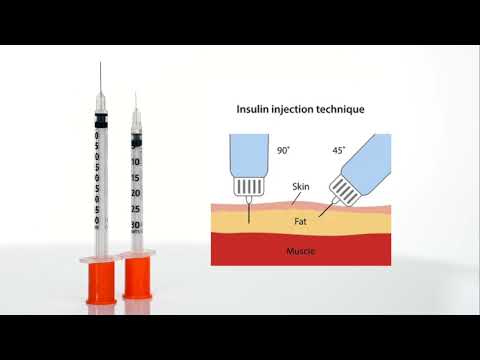 How to choose the right Easy Touch syringe