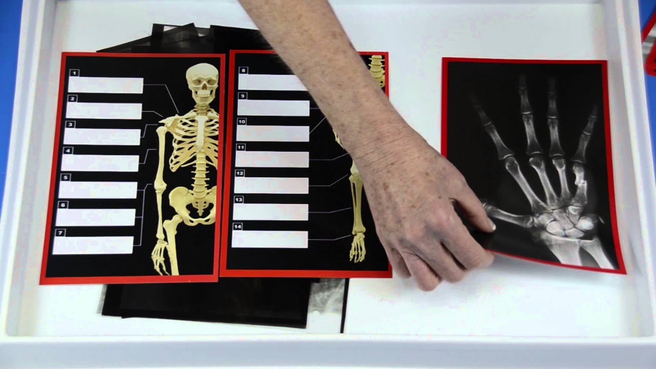 59255 Fixed Bone X-Rays