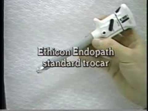 Prof Anthony Nobles Visioneering Visualization Trocar 1992 ...