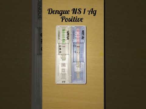 Dengue NS1 Ag Positive 😱