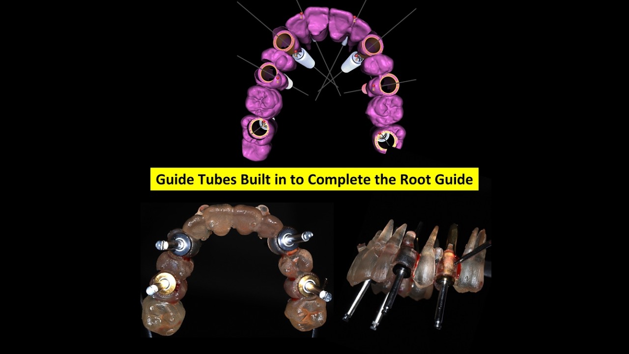 Root Guide - Part 2     Software tutorial