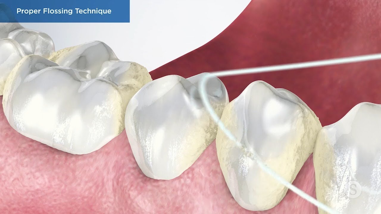 Proper Flossing Techniques