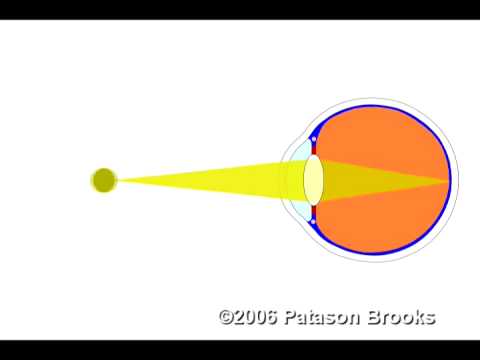 The Process of Accommodation In the Eye