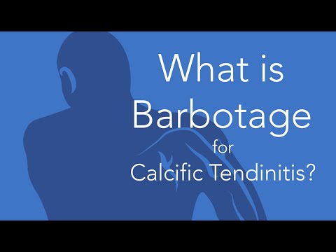 What is Barbotage for Calcific Tendinitis?