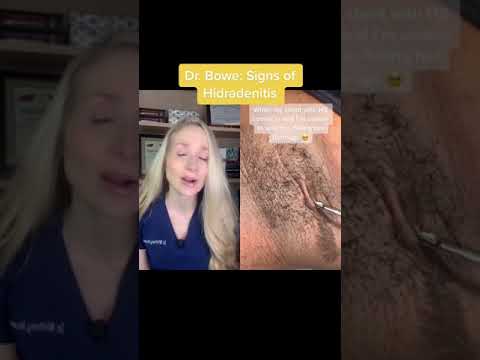 Dermatologist on the skin condition hidradenitis #Shorts