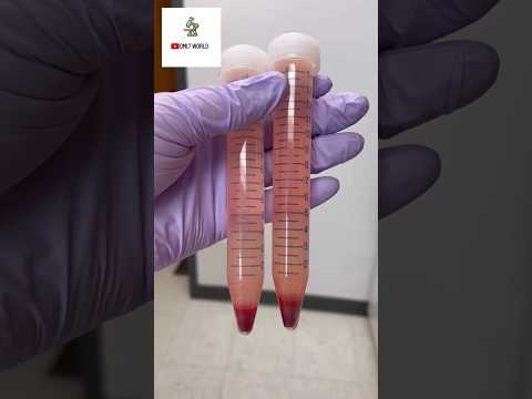 Red Blood Cells Lysis 🩸🧪#shorts #science #shortvideo #laboratory #labtech #Dmlt @dmltworld