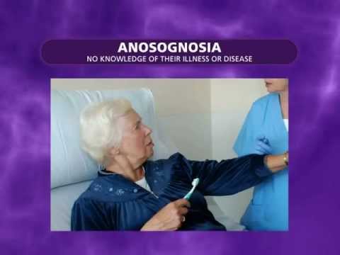 Considerations for Dementia - The most common 'losses' of dementia (the 7A's)
