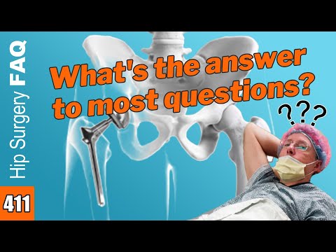 "IT DEPENDS" is the answer to most questions about Total Hip Replacement