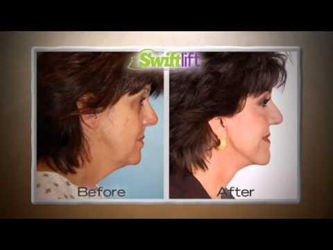 Seattle Swiftlift Commercial - Dr. Craig Jonov - Lynnwood, WA