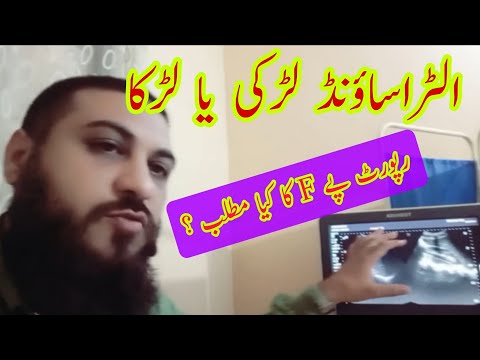 F mean ultrasound | baby boy or girl | F Girl USG #genderreveal