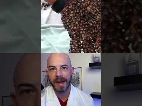 Derm reacts to “tick” infestation! #dermreacts #doctorreacts #tickinfestation