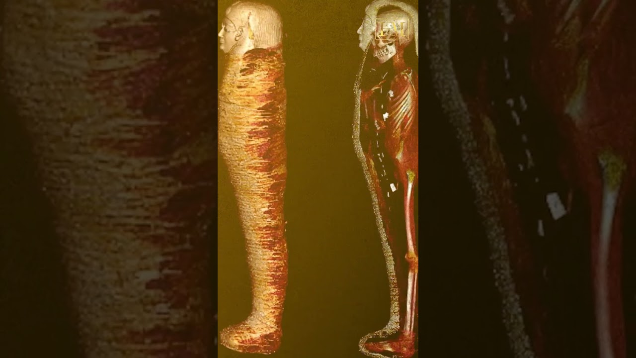 Egyptian mummies covered in gold are rare, and we may have just found oldest #history