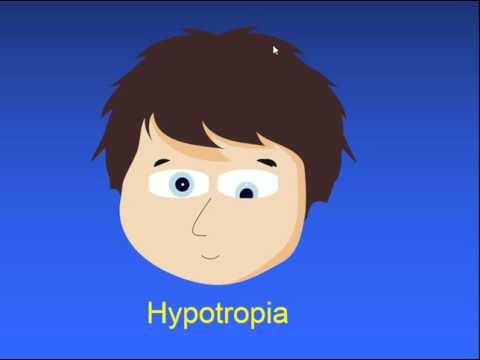 Diplopia - 1/6 Introduction