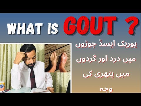 What is Gout in Urdu/Hindi | Gout kya Hai | causes of Gouty Arthritis | High Uric Acid ki waja