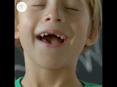 PEDIATRIC STEEL CROWNS IN BANGALORE at Dentick Dental Care in BTM Layout