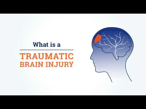 What is a traumatic brain injury? What are the 3 top causes of TBI?