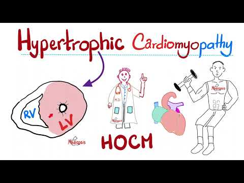 Hypertrophic Cardiomyopathy (HOCM) - Sudden Cardiac Death - Cardiology Series