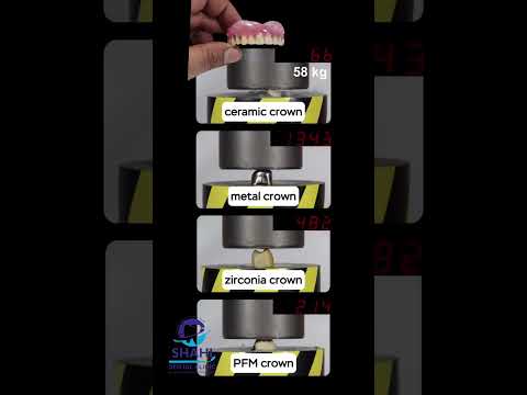 Types of Dental Crowns Tested for Strength | Shahi Dental Clinic Video Demo