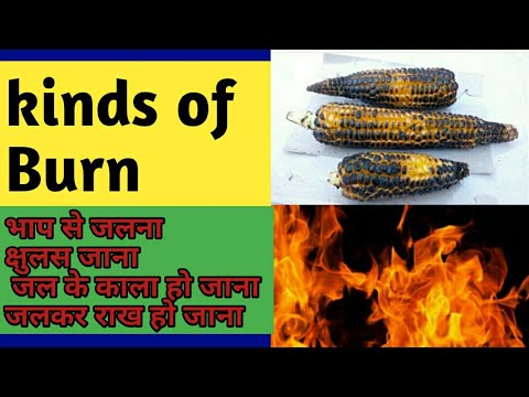 kinds of Burn /the meaning of scorched,scalded,Blackened and Burnt🔥🔥