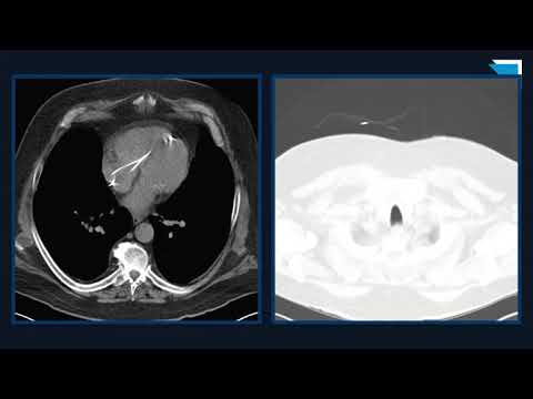 Great Calls! | 15 Minute Radiology CME