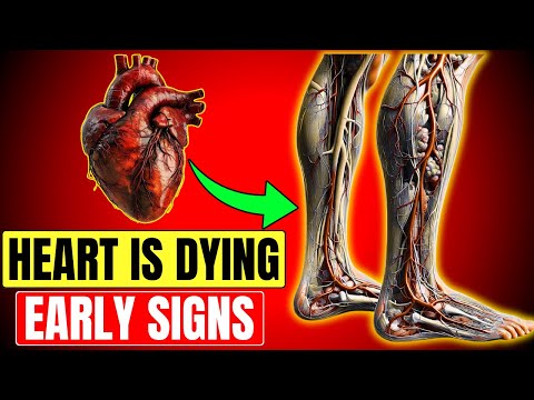 10 Warning Signs of Blocked Heart Arteries In Legs and Feet (Don't Ignore These Signals)
