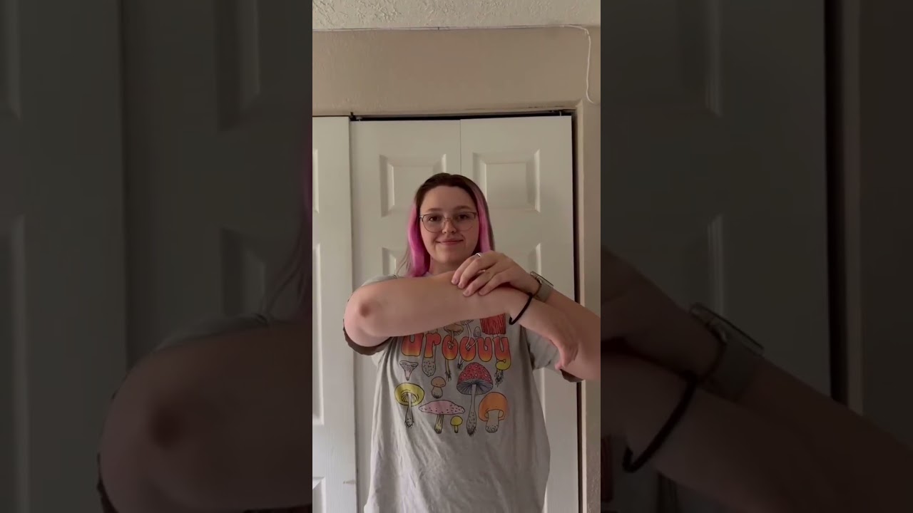 Hypermobility can look different on everyone!