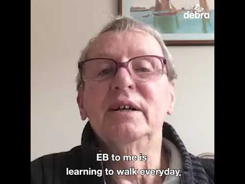 What is EB to me? - Terry Cook #EBAwarenessWeek