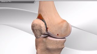 Patient Education in Orthopedic Surgery – OrthoIllustrated