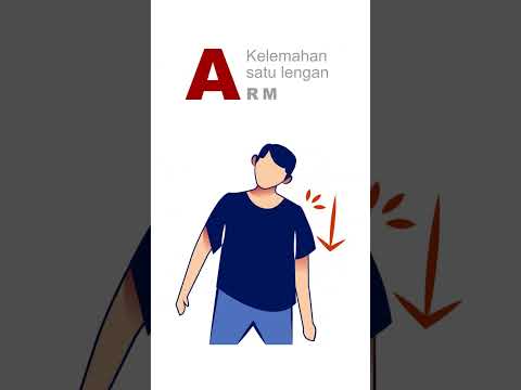 Tanda Awal STROKE ( F A S T ) #SIAGASTROKE