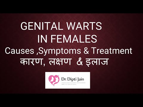 GENITAL WARTS IN FEMALES - कारण , लक्षण और इलाज / Causes , Symptoms & Treatment (HINDI)