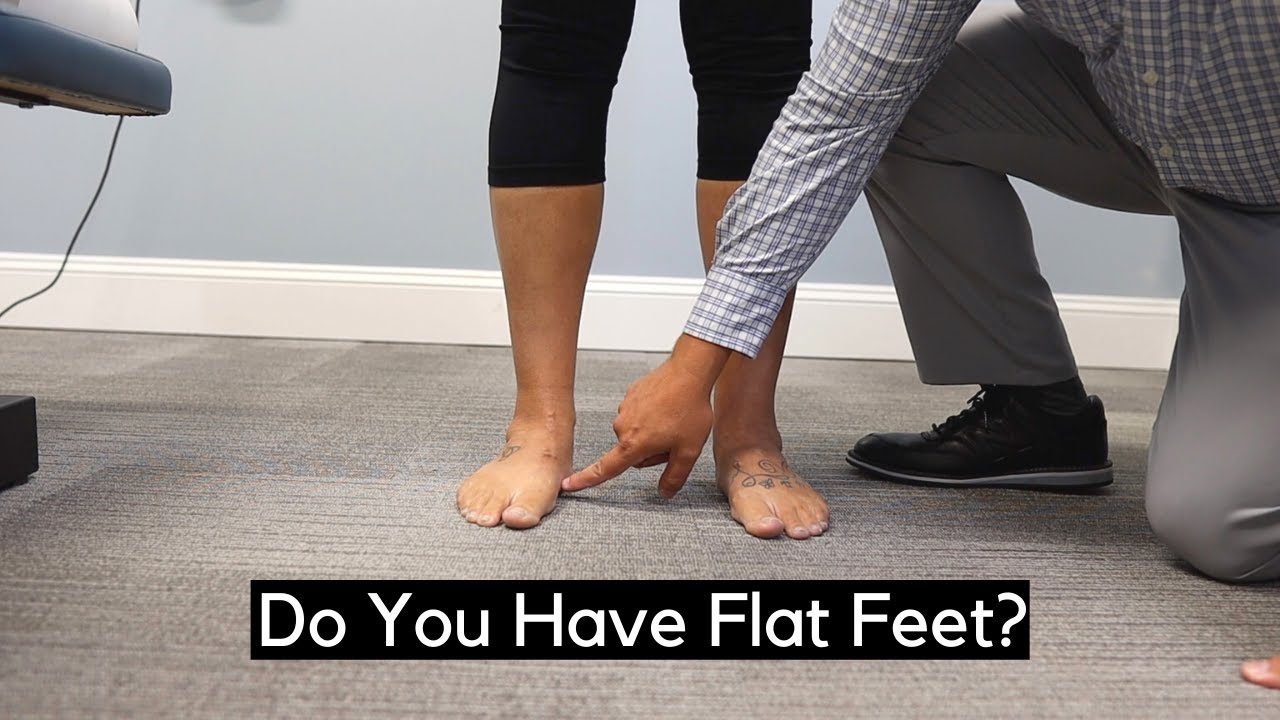 How To Tell If You Have Flat Feet