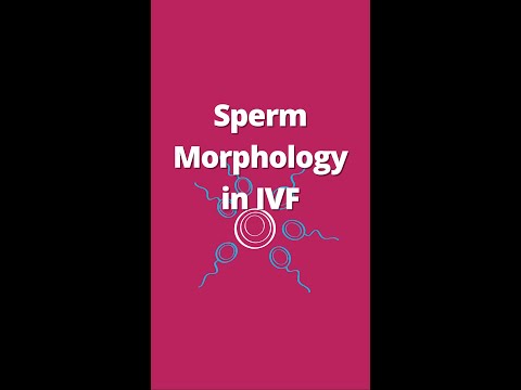 Sperm morphology refers to the size, shape, & appearance of a man's sperm #youtubevideos #ivfclinic