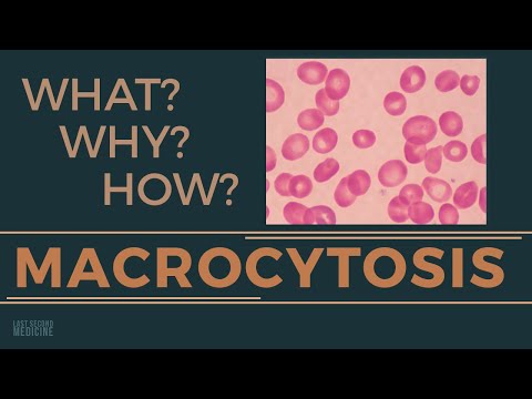 Macrocytosis - WHAT is it, WHY is it (Causes), HOW to investigate | RAPID OVERVIEW OF MACROCYTOSIS