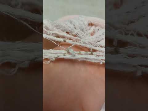 carpet beetle larva fuzzies in clothing and linens?
