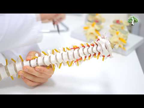 Vertebral artery syndrome symptoms, treatment, diagnosis, causes