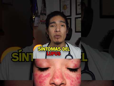 Qué causa el lupus? #medicina #salud