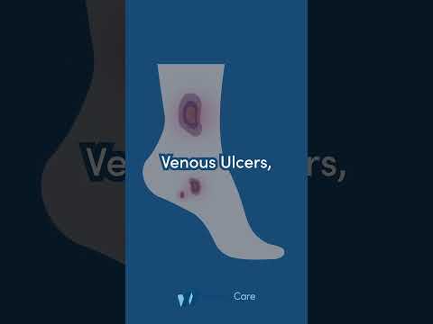 Peripheral Arterial Disease facts (PAD) #shorts #PAD #woundcareadvantage