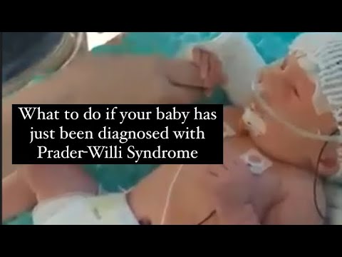 New diagnosis of Prader-Willi Syndrome