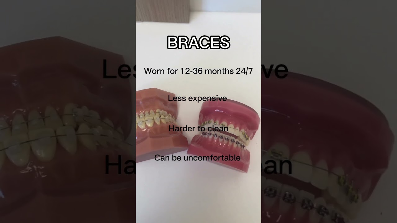 Braces VS Invisalign 🦷👀