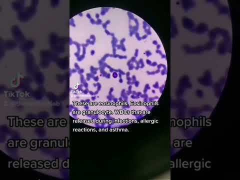 Eosinophils WBC #laboratory #medtech #medtechstudent #bloodsmear #peripheralbloodsmear #bloodcells