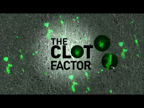 Full Measure: November 26, 2023 - The Clot Factor