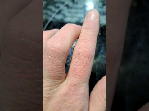 the cold dry truth about a dog groomers hands 😲