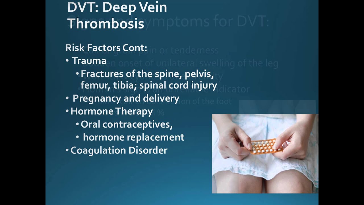Deep Vein Thrombosis ppt mmb vo
