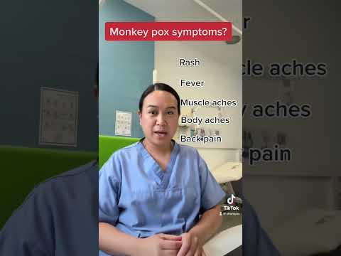 What are the symptoms of monkey pox?