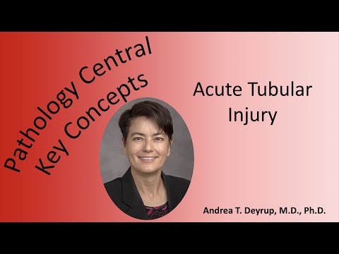 Medical School Pathology: Pathophysiology of Acute Tubular Injury