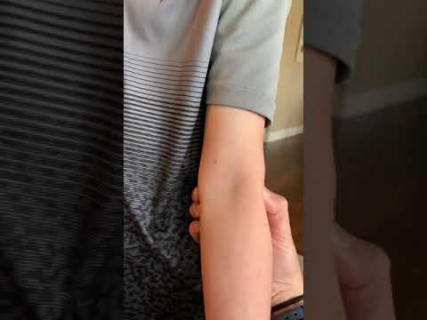Palpation: Head of Radius